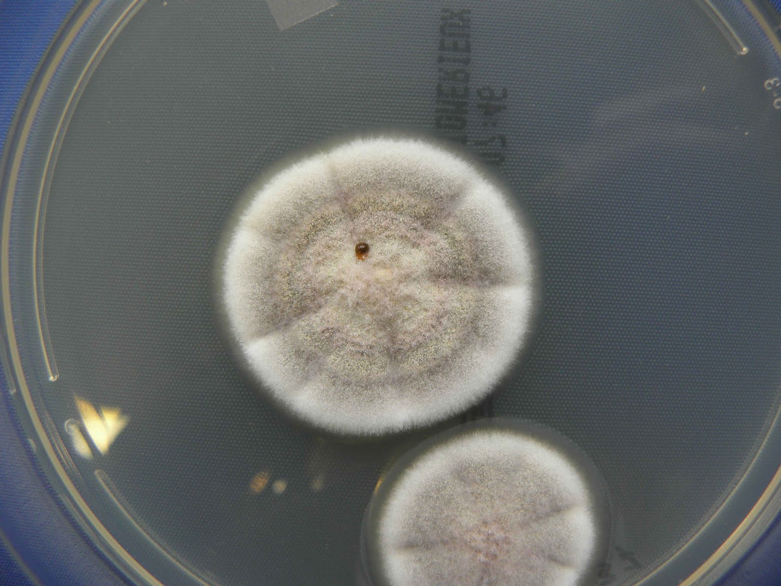 ATLAS MICOLOGIA: ASPERGILLUS USTUS COMPLEXO