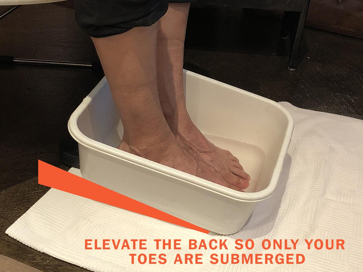 Foot and Ankle Problems By Dr. Richard Blake: Toe Nail Fungus: 30 ...