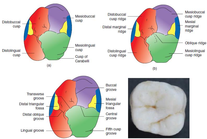 Maxillary 1st molars l Dental anatomy revision - WikiDentia