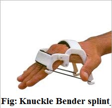 Knuckle Bender splint