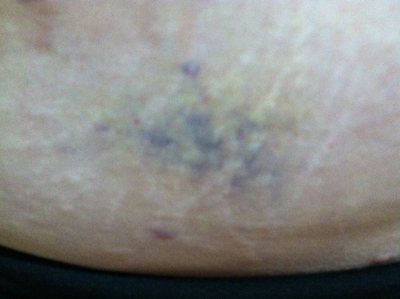 Our Journey: IVF: The Scary Truth: More Pictures