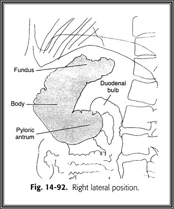 Catatan Ku: Oesophagus Maag Duodenum (OMD)