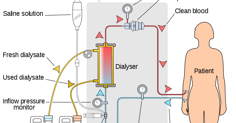 Biomedical Engineering: All You Need About Dialysis Machine Preventive ...