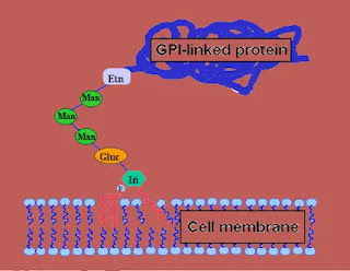 Paroxysmal Nocturnal Hemoglobinuria (PNH)