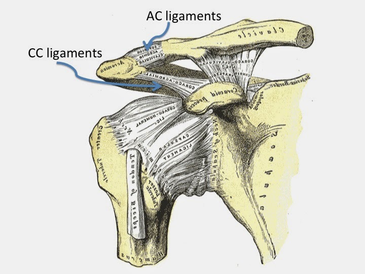 Shoulder and Elbow Surgery: "Shoulder Separation" or Collar bone ...
