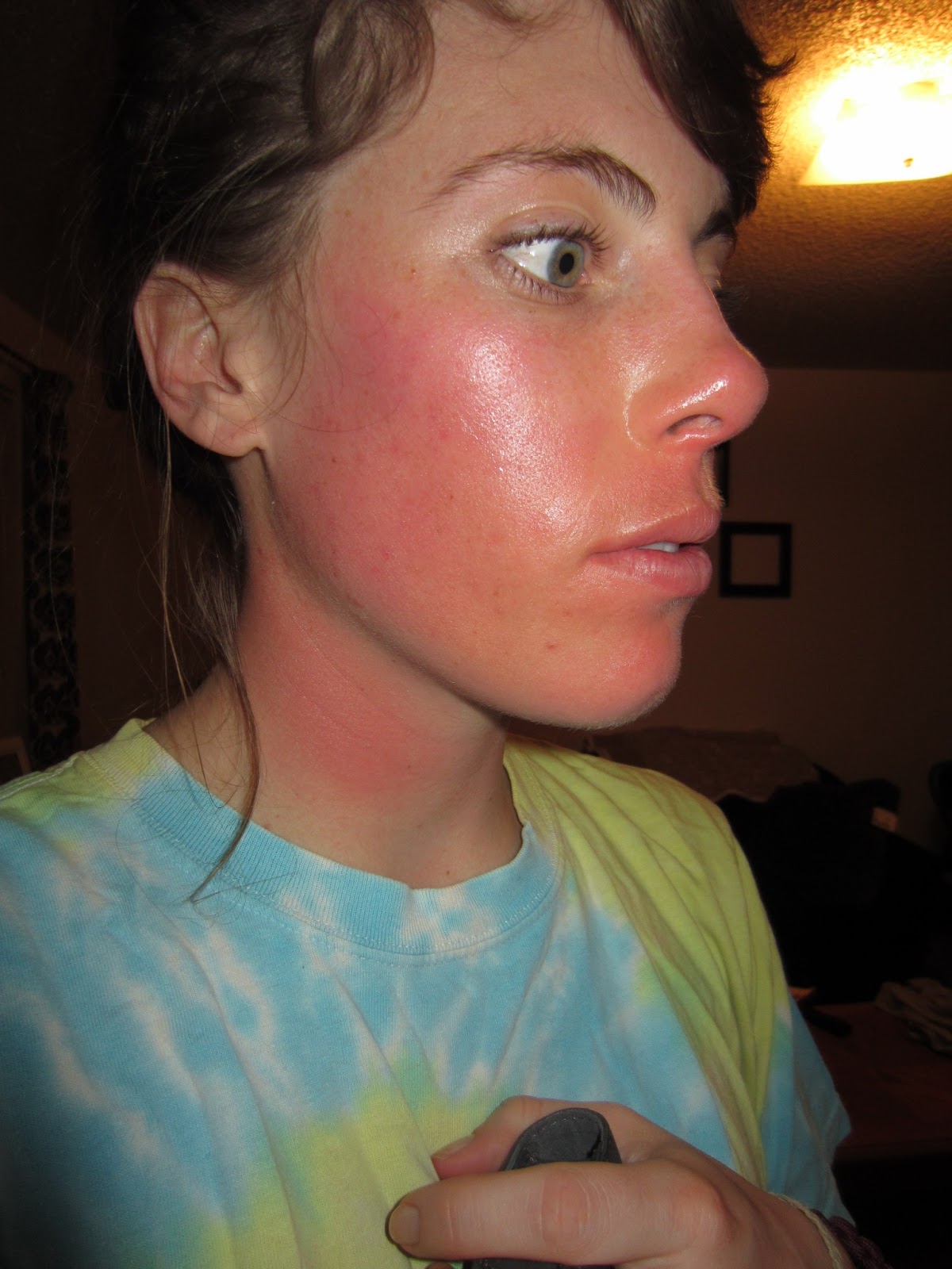 i learned that the hard way: Wind Burrrrrrrn!