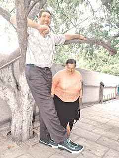 Mi Dulce Espera: La Acromegalia y el Gigantismo