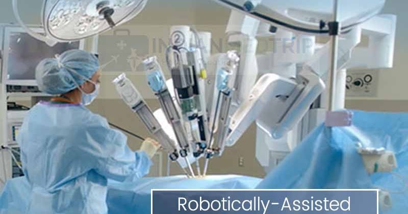 Robotically-Assisted Prostate Cancer Surgery in India ~ Healthcare In India