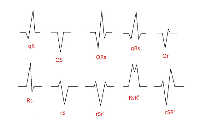 ECG of the Week: ECG Reference Notes