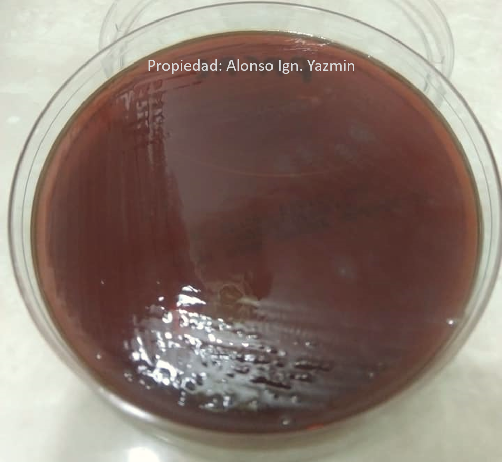 Bioquímica Diagnóstica BQD-YAI: Proteus mirabilis