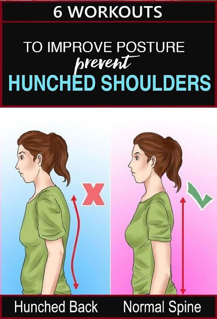 These 6 Workouts Help You Prevent Hunched Shoulders - Healthy Lifestyle