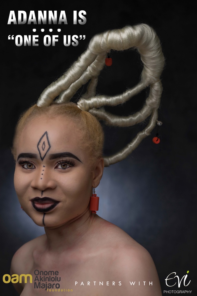 Fashion Foward: "One Of Us" - Albinism Awareness Campaign