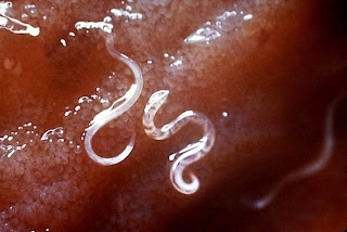 BIOLOGÍA: ¿QUÉ ES EL PARASITISMO?