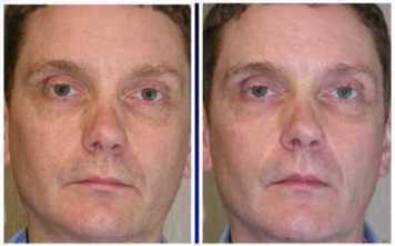 Facial Development Newsletter: March 2011