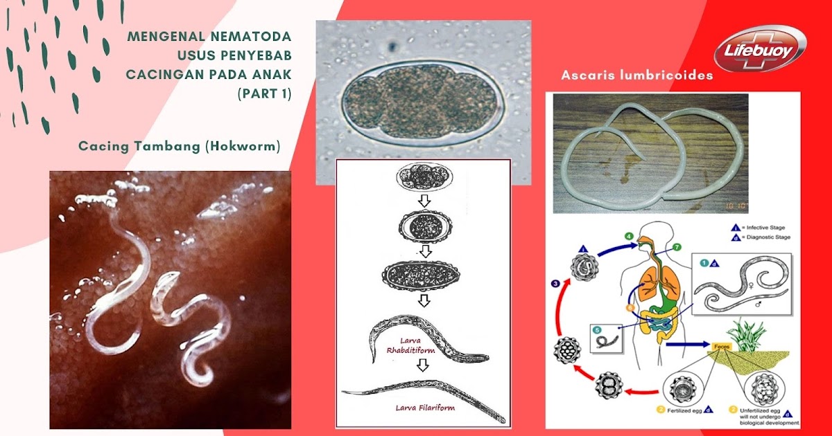 Mengenal Nematoda Usus Penyebab Cacingan pada Anak (Part 1) - Hanya ...