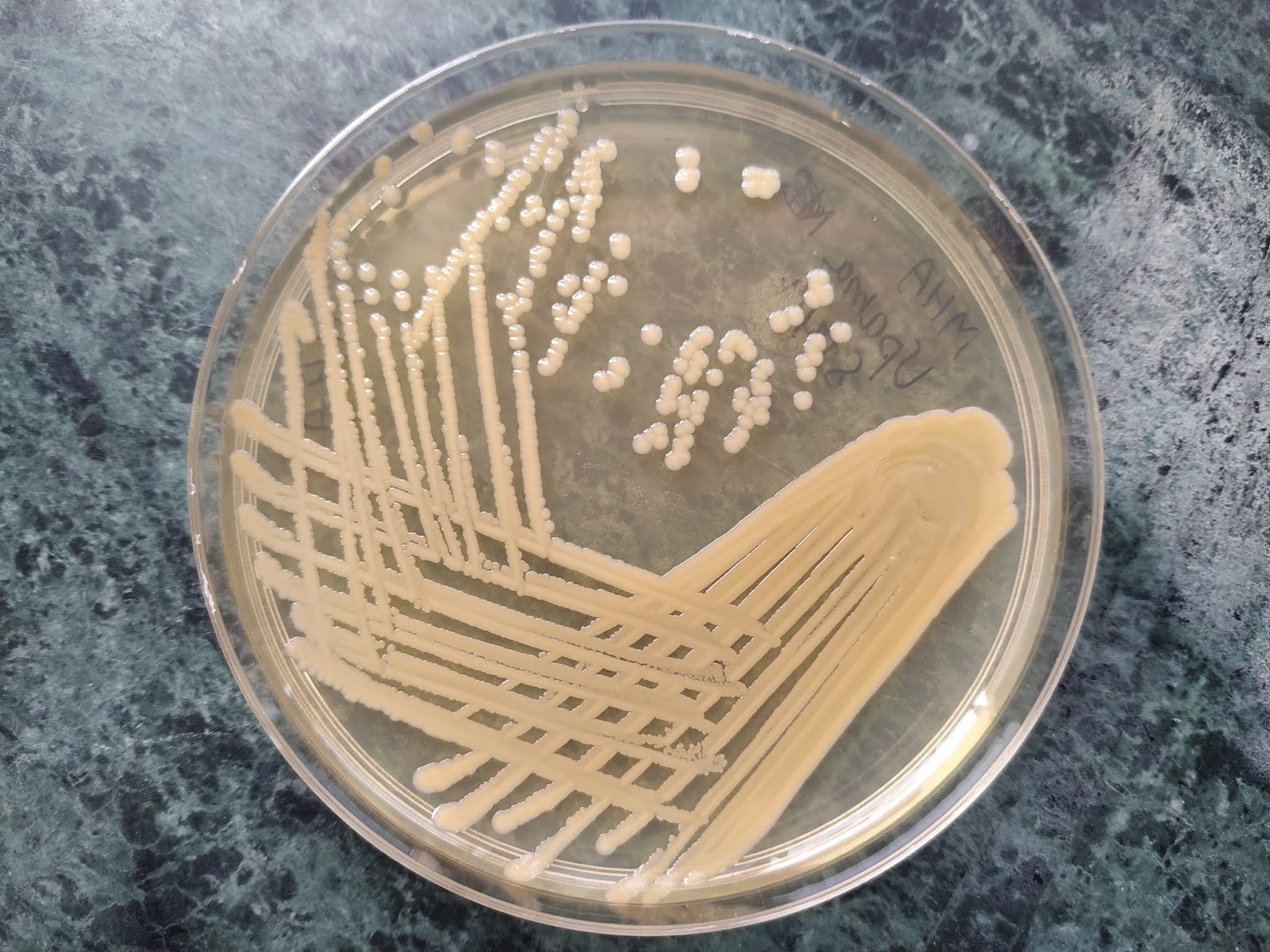 MICROBIOLOGY BLOG FOR STUDENTS (MBLOGSTU): Cultural and Biochemical ...