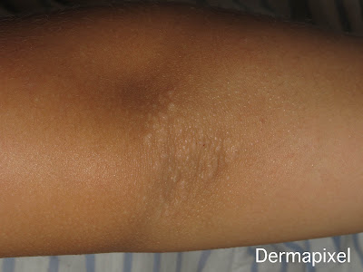 Dermapixel: agosto 2019