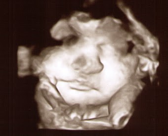 Count Your Blessings: 38 weeks ultrasound pictures