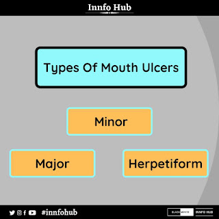 Mouth Ulcer-Treatment & Causes