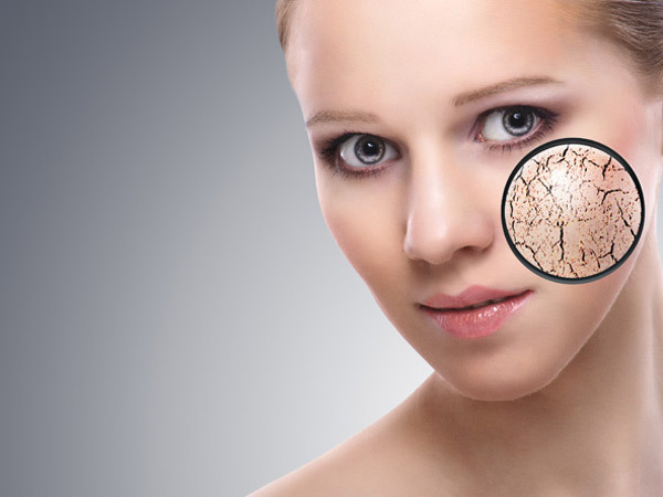 Beauty tips: Beauty tips for dry skin: