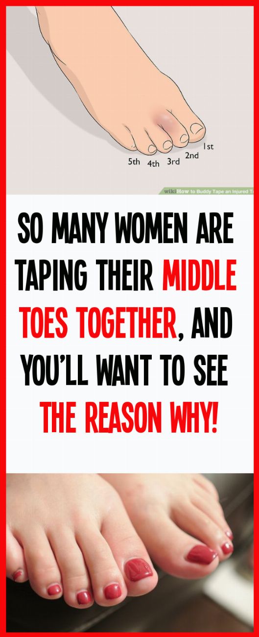 So Many Women Are Taping Their Middle Toes Together, And You’ll Want To ...