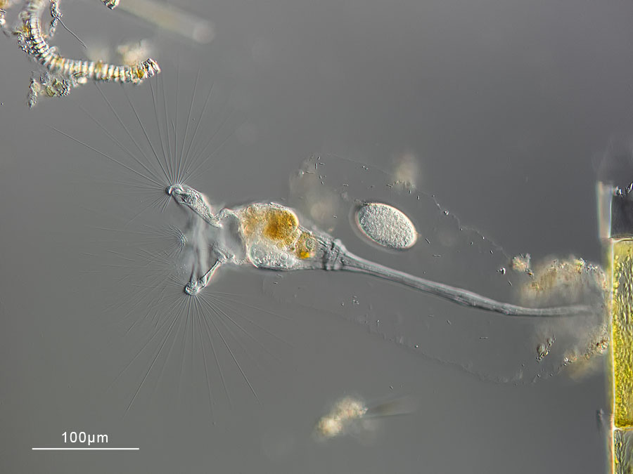 明石・神戸の虫 ときどきプランクトン2: ハナビワムシの一種（Collotheca sp.）