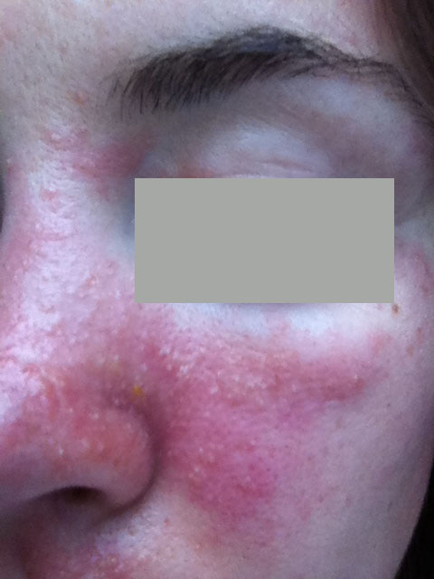 VIRTUAL GRAND ROUNDS IN DERMATOLOGY 2.0: Deadline Looming