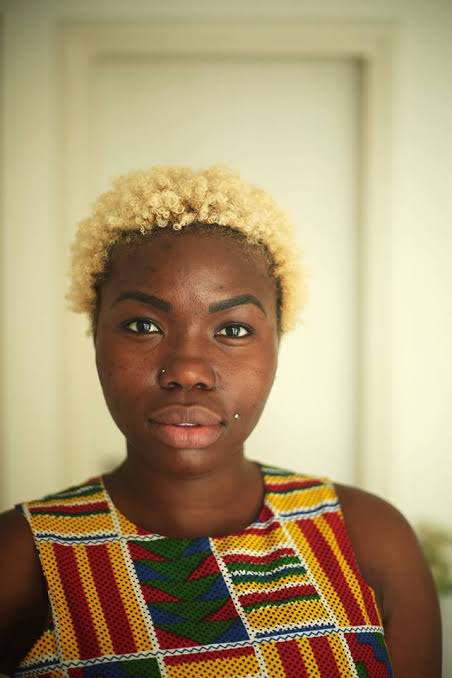 Pictures of Maria Mobil Before Surgery