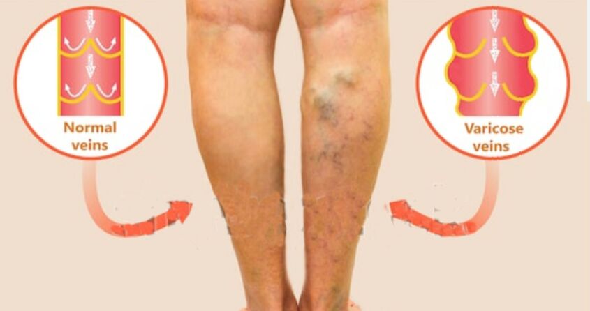 Side Effects Of Prolonged Sitting And Its Solutions. | Fit Guest