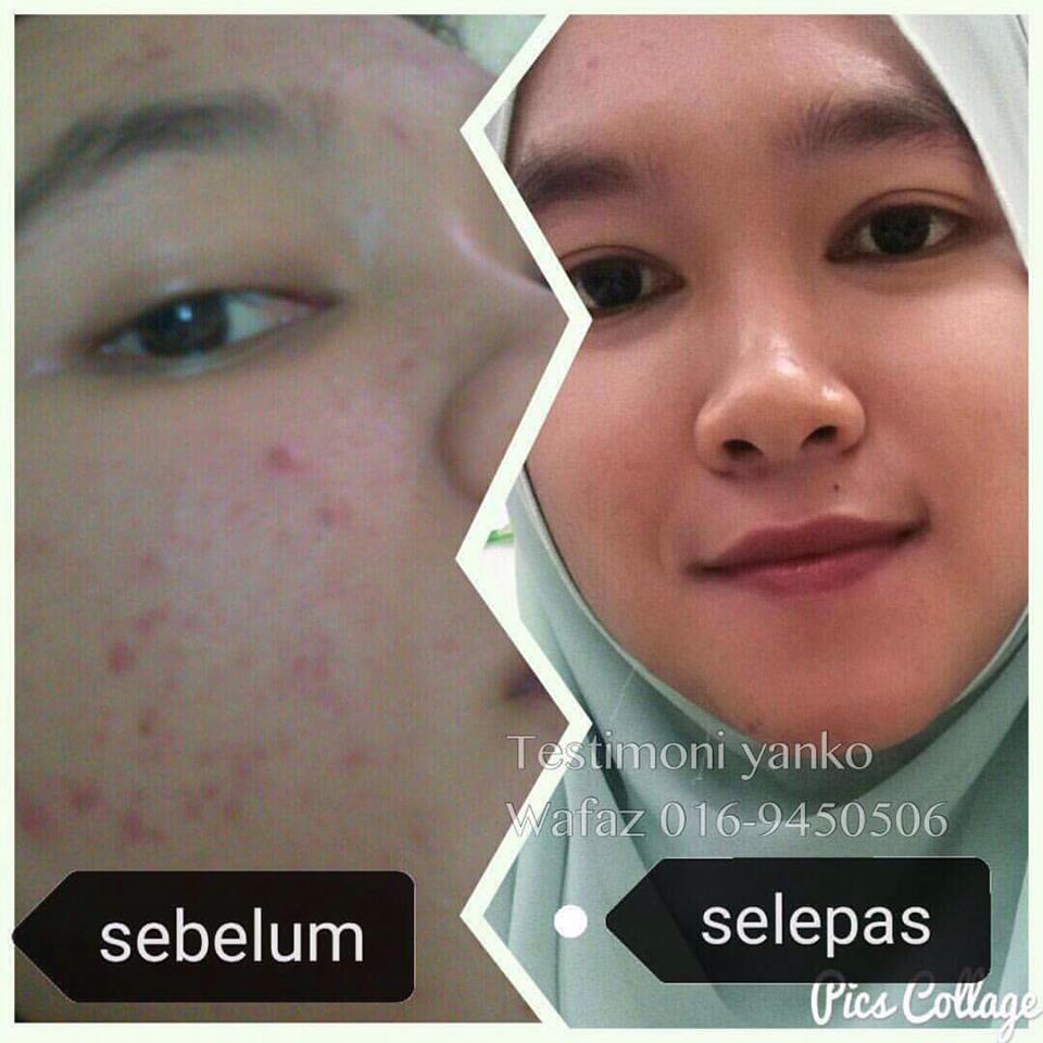 Natural Health Be Young: TESTIMONI YANKO SKINCARE