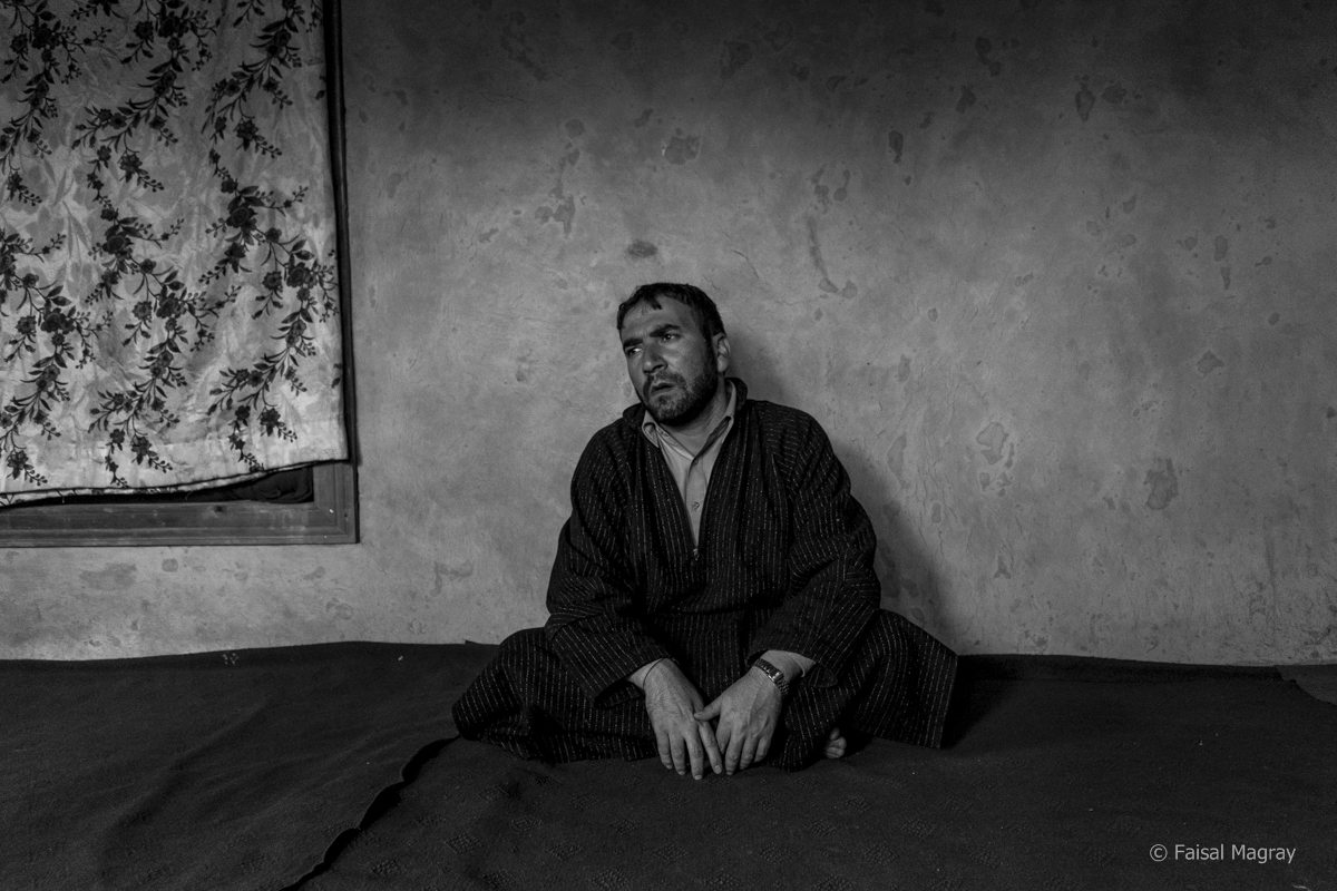 The depth of a scar | Faisal Magray