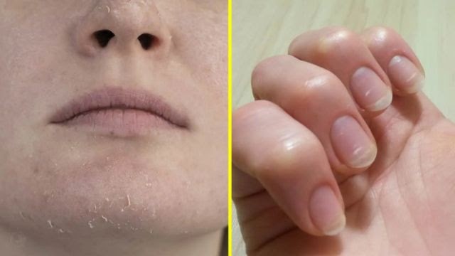 20 Signs That Reveal Nutritional Deficiencies in Your Body