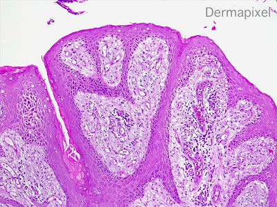 Dermapixel: marzo 2021