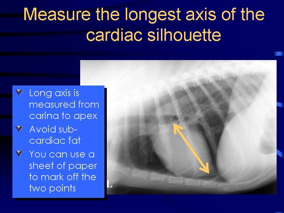 Imacardio: El Vertebral Heart Score (Índice cardiaco vertebral)
