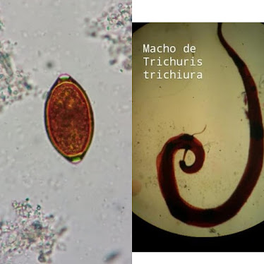 PARASITOLOGIA: TRICHURIS TRICHIURA