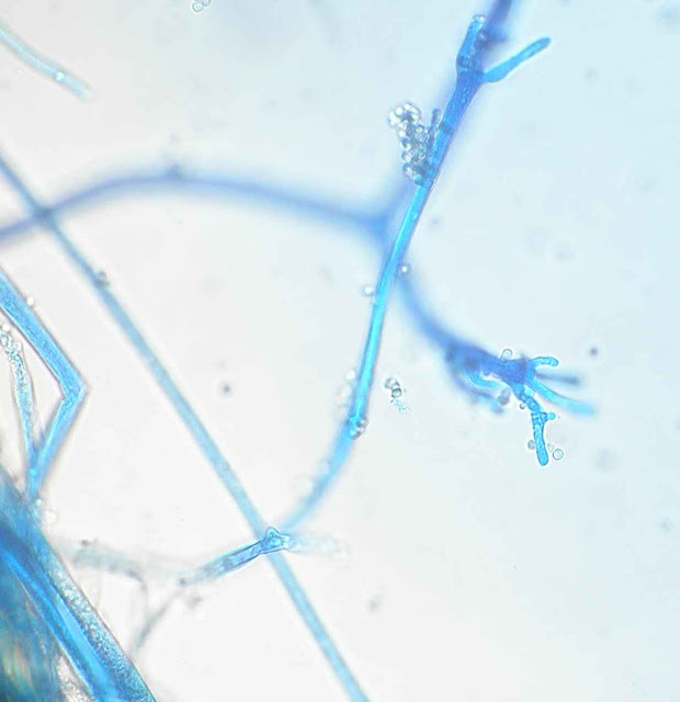 ATLAS MICOLOGIA: SYNCEPHALASTRUM RACEMOSUM