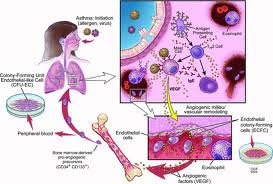 Pathophysiology of Asthma - Understand for Prevention - How To Treat ...