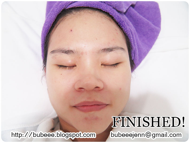 ♥ Bubeee ♥ 【療程】 即時改善暗瘡。去痘印 Skinmax肌妍美容中心。醫療版e Light 極速美白緊緻療程
