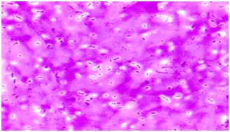 MICROBIOOLOGIA Y PARACITOLOGIA : Enterobacter aerogenes