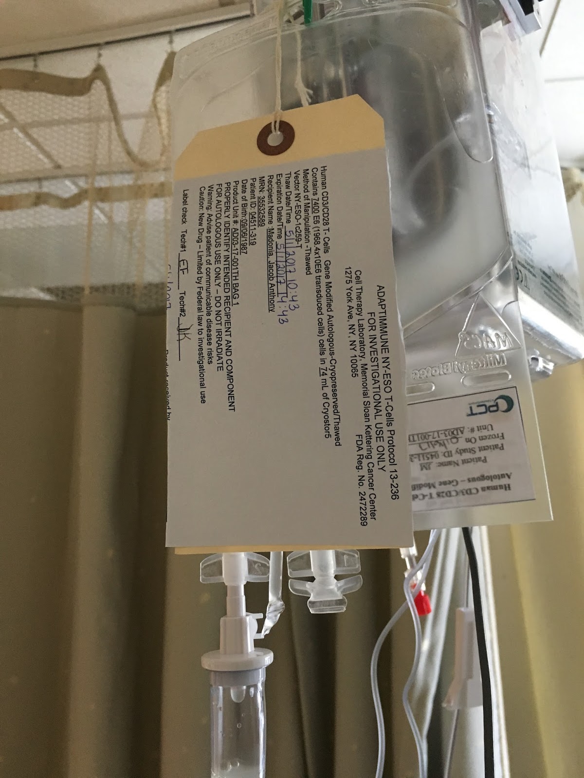 My Life with Stage IV Synovial Sarcoma: T Cell Infusion. Day 0!