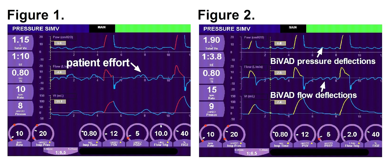 FREMITUS: Vent Graphics Contest WINNERS