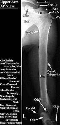 DUNIA RADIOLOGI: TEKNIK PEMERIKSAAN HUMERUS