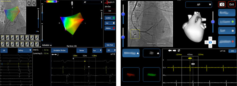 Easy to Use Navik 3D Cardiac Mapping System Cleared in U.S. ~ OUR ...