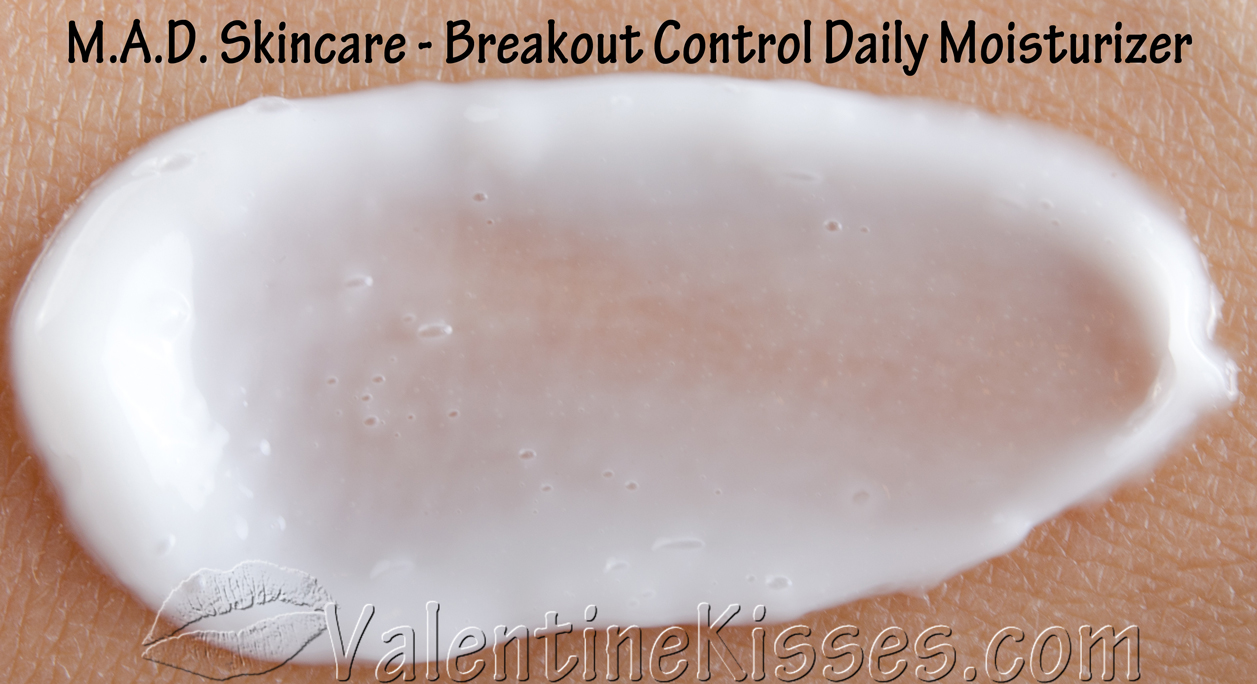Valentine Kisses: M.A.D. Skincare - 3 products for Acne/Blemish Prone ...