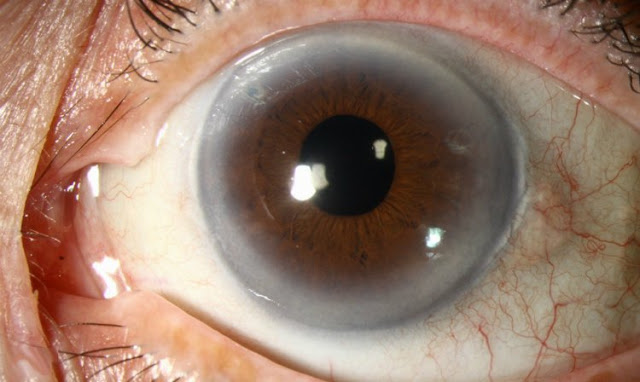 Trivial Facts That Might One Day Save Your Life - prove