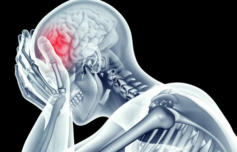 Mioclonia - A Doença do Movimento - Saúde & Conhecimento