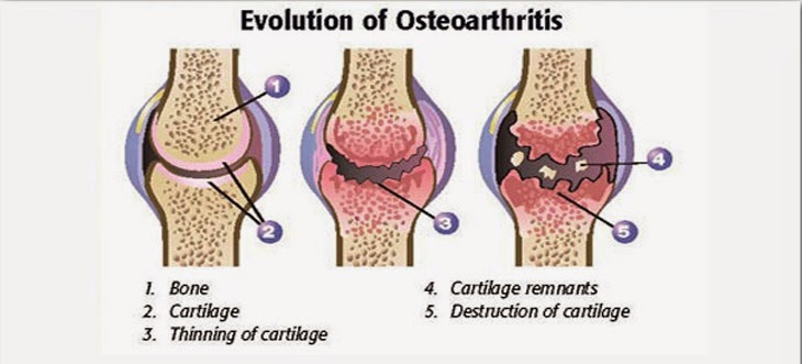 Your Pet is in Good Hands: Arthritis in your animals