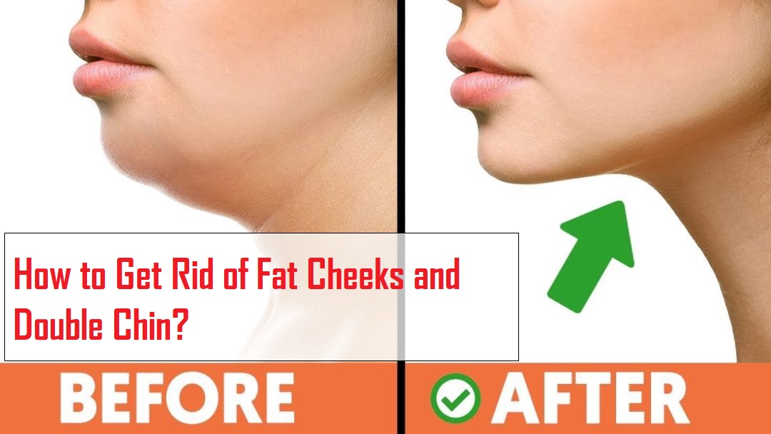 How to Get Rid of Fat Cheeks on Face and Double Chin?
