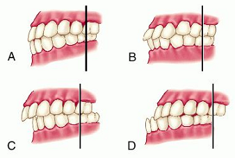 PROTESIS DENTAL : oclusion I