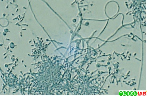 [Parasitology] Atlas of Medically Significant Fungi | Free Medical Atlas
